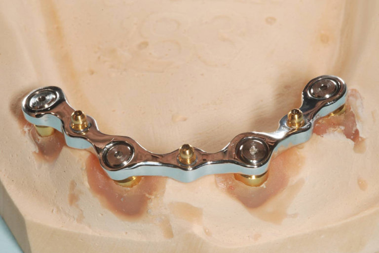 OT Cap Micro M1.6 ‣ RHEIN83