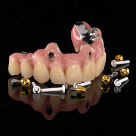 Fixed Prosthesis OT Bridge | Rhein83