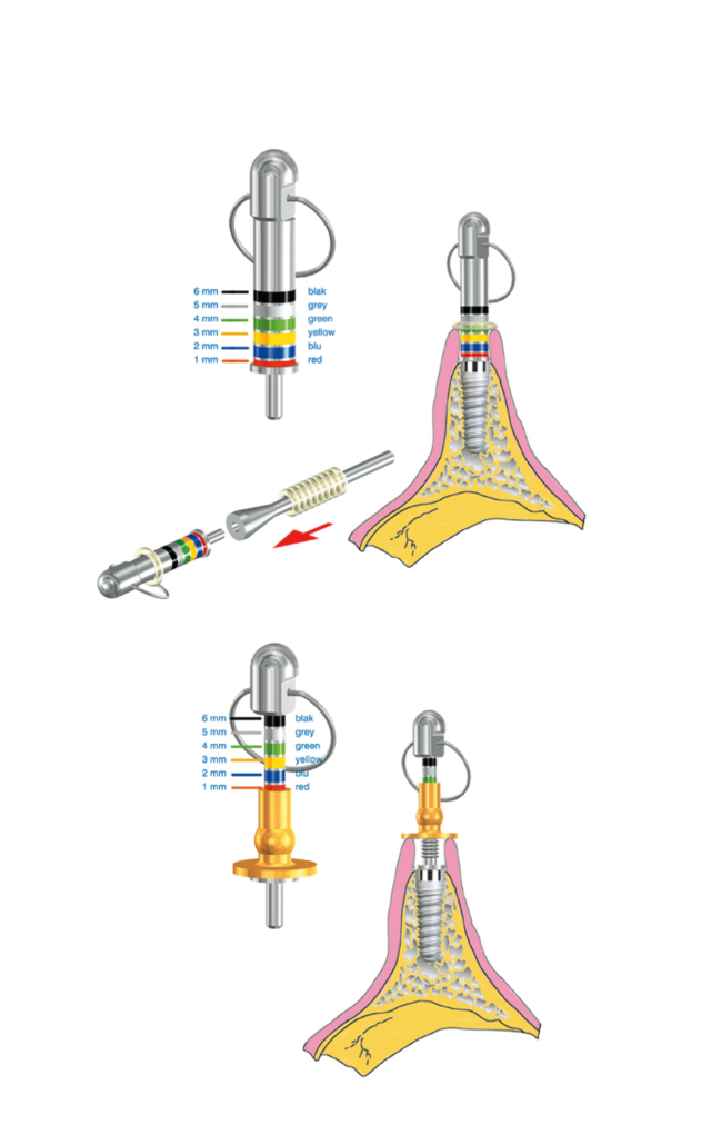 CUFF HEIGHT MEASURER TOOL ‣ RHEIN83