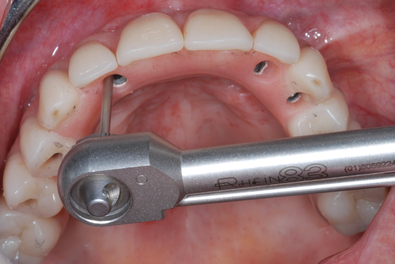 Ferrari_Ot bridge sup | RHEIN83