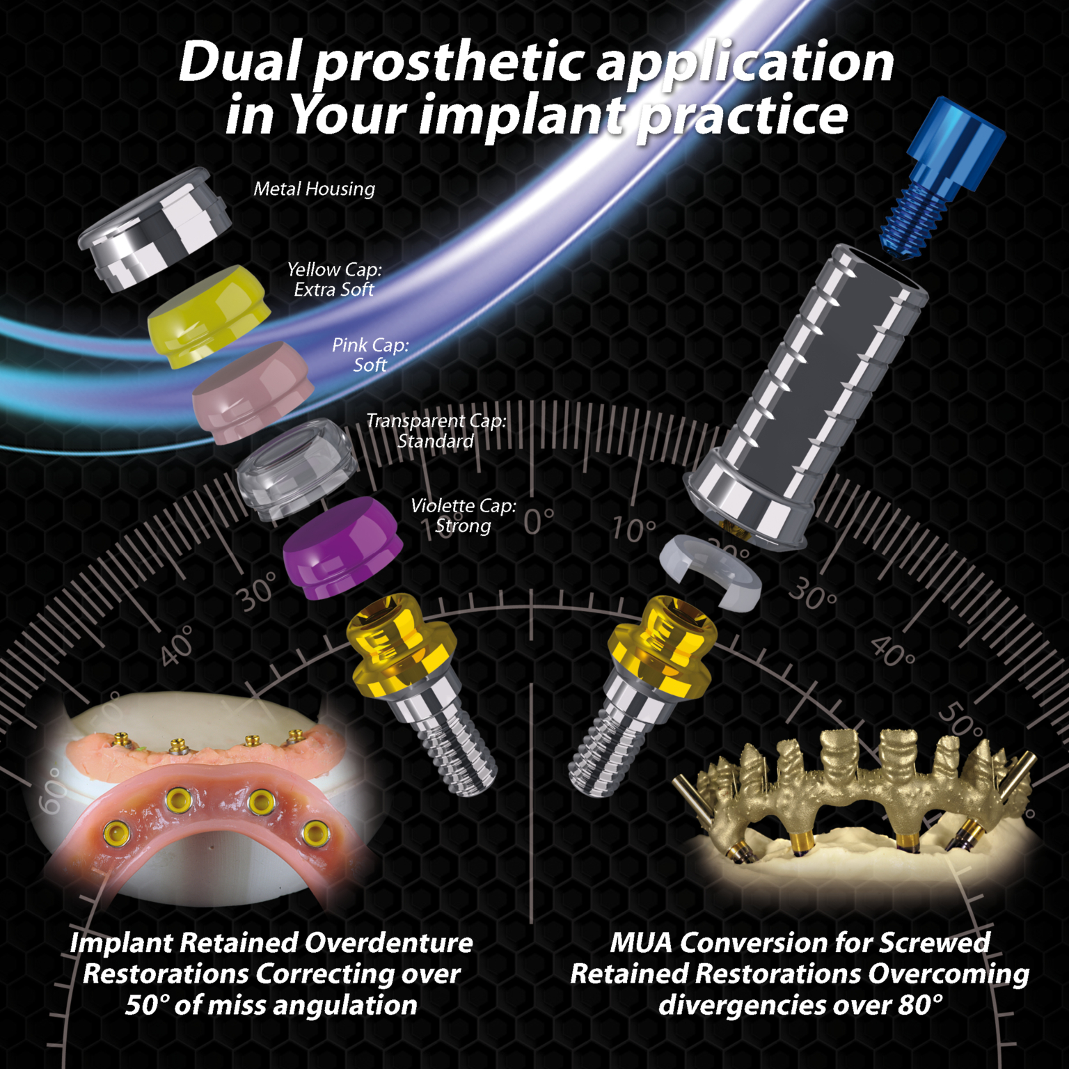 OT EQUATOR ATTACHMENT: FOR ALL IMPLANT PLATFORMS | Rhein83