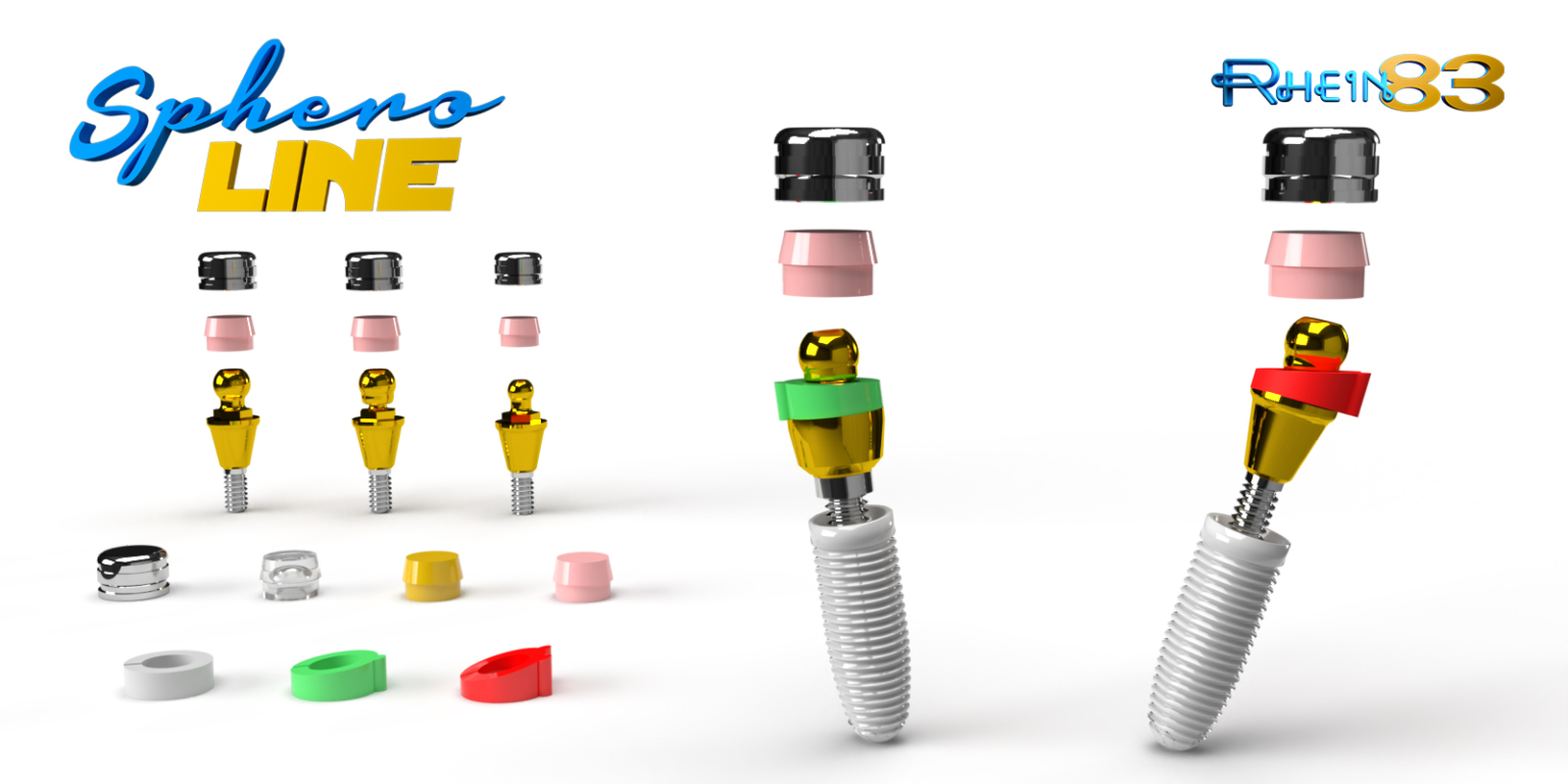 Implant retained overdenture with Ball Attachments | Rhein83