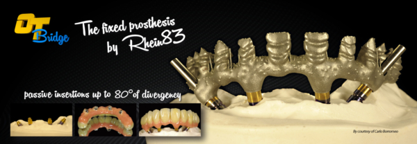 Fixed Prosthesis OT Bridge | Rhein83