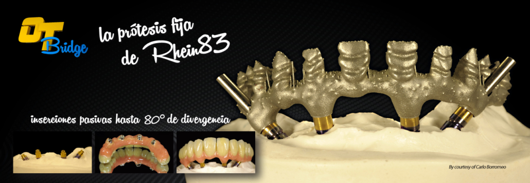 Prótesis fija OT Bridge | Rhein83
