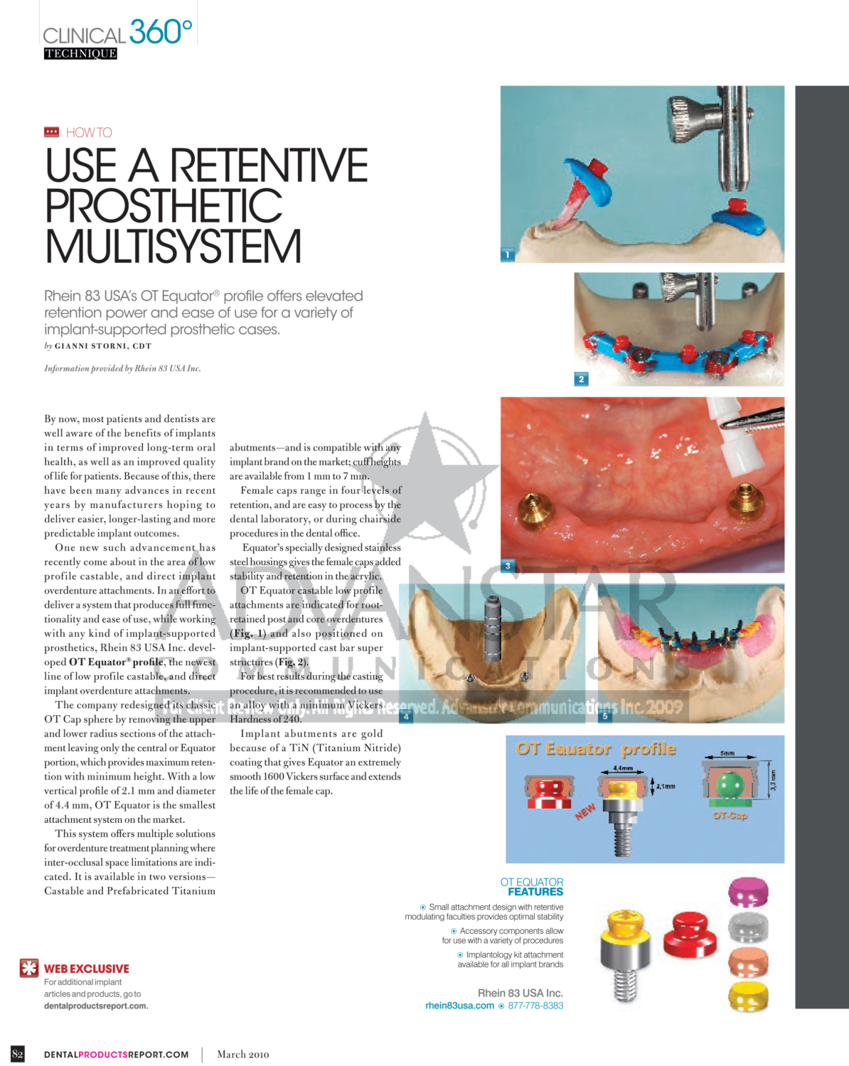 HOW-USE-A-RETENTIVE-PROSTHETIC-MULTISISTEM-1 | Rhein83