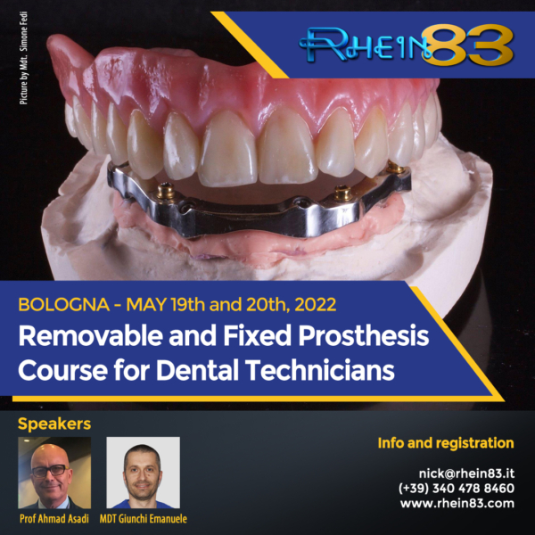 Extracoronal | Rhein83