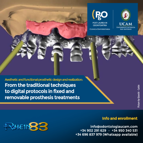 CAD/CAM Bars | Rhein83