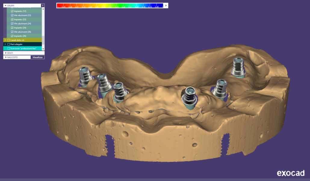 OT EQUATOR PROSTHETICS RESTORATIONS | Rhein83