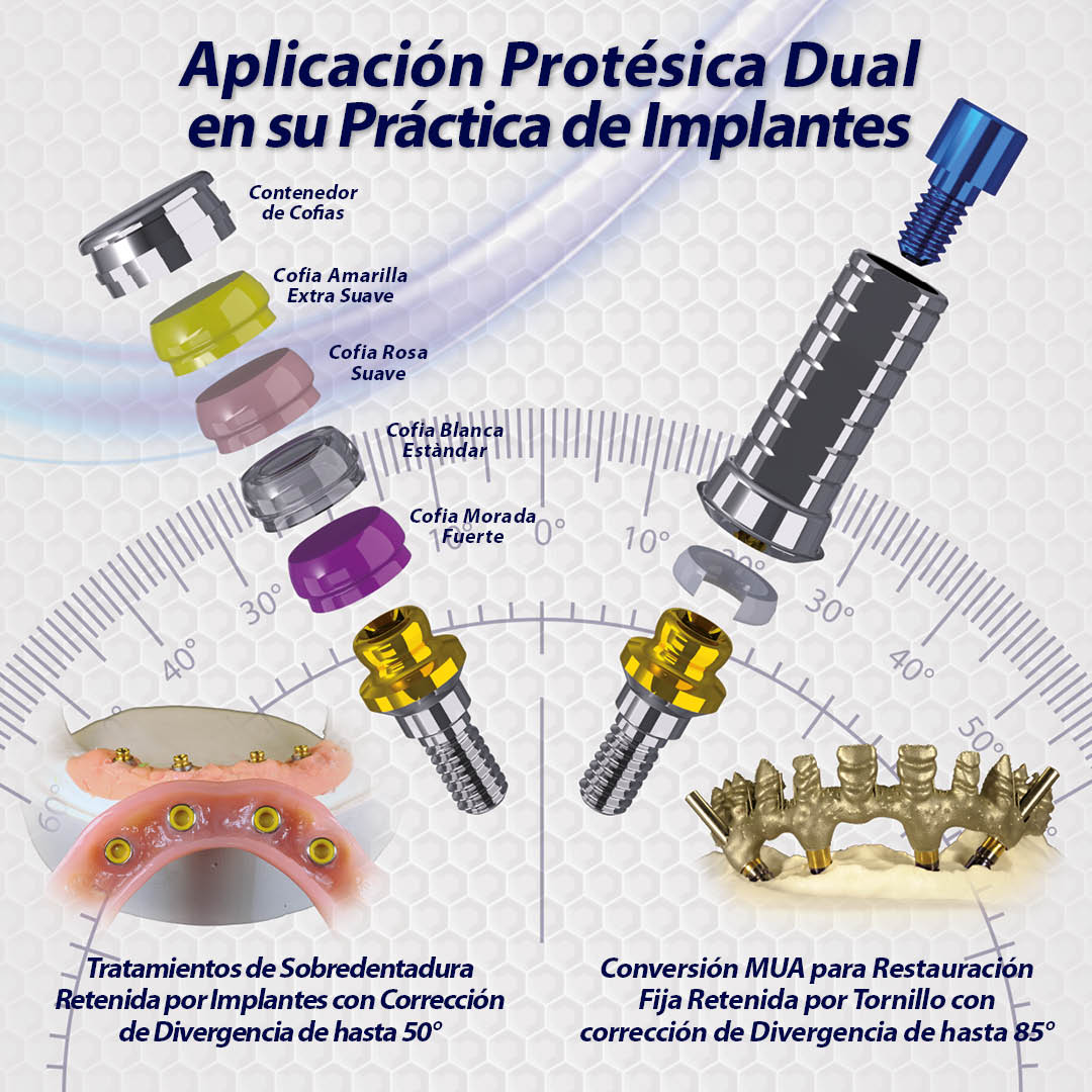 Restauraciones protésicas OT Equator | RHEIN83